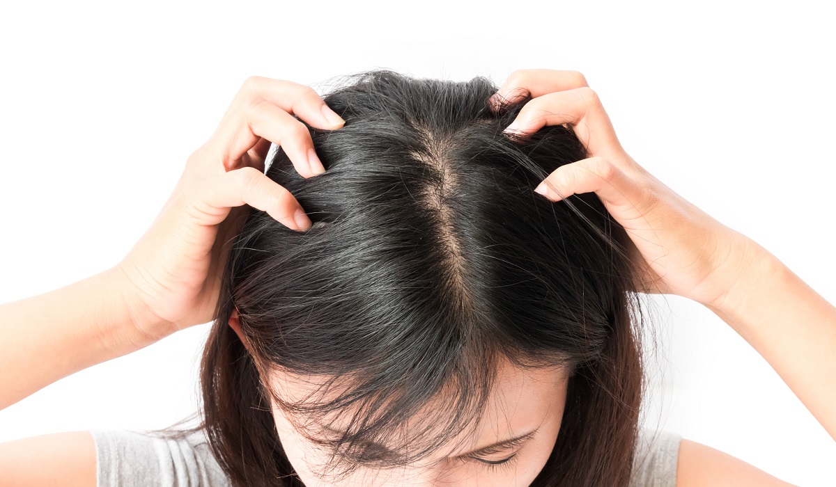 Understanding the Causes of Different Scalp Conditions - Curate Gifts